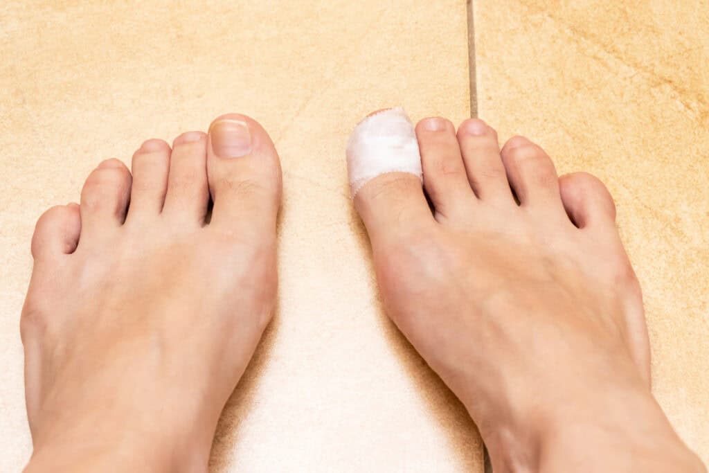 How Long Does It Take for a Toenail to Grow Back? - Yeargain Foot & Ankle